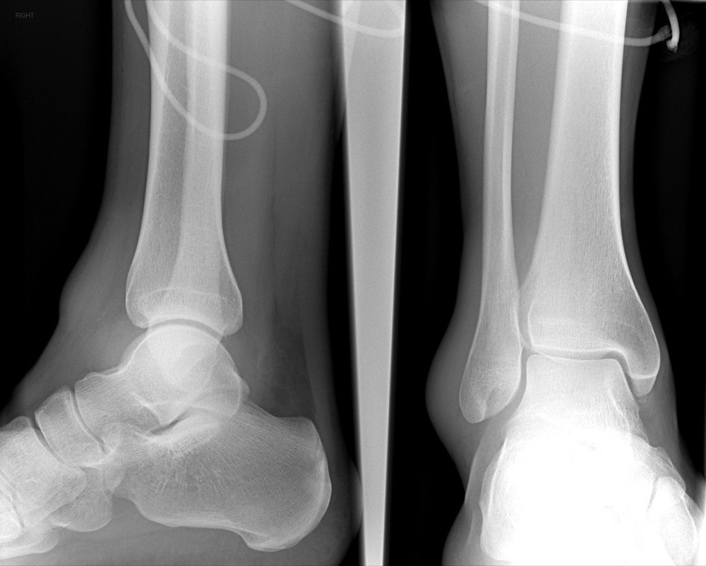 Surgery Now Accepting Positive Thoughts Moto Related Motocross