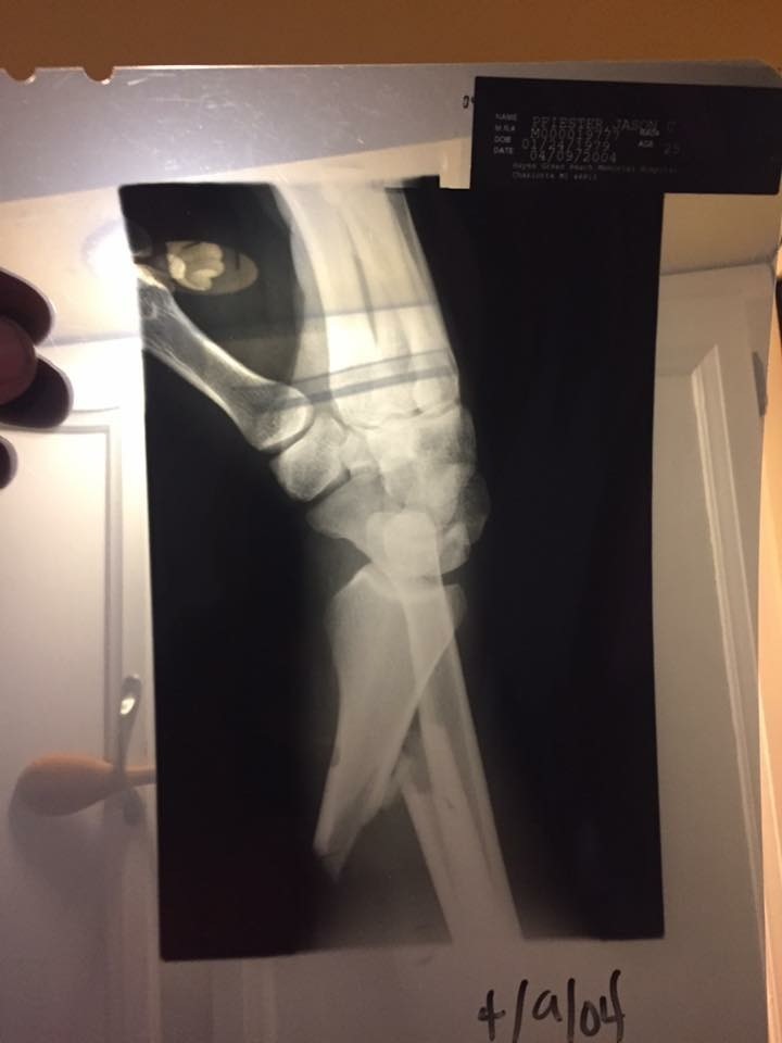 Roczen Update - Moto-Related - Motocross Forums / Message Boards - Vital MX