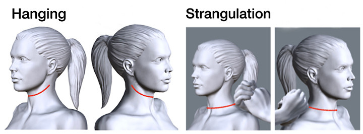 Epstein technical difficulties - Non-Moto - Motocross Forums / Message ...