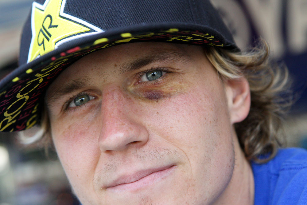 Jimmy Albertson - Vital MX Pit Bits: Steel City 2011 - Motocross ...