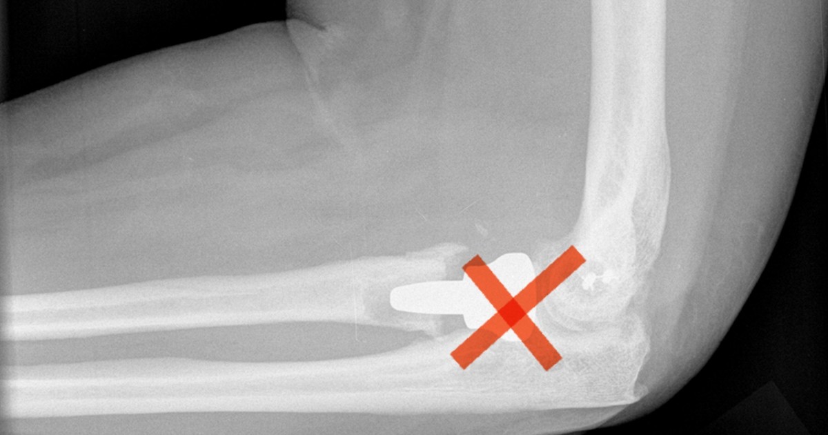 Christian Craig - Moto-Related - Motocross Forums / Message Boards ...